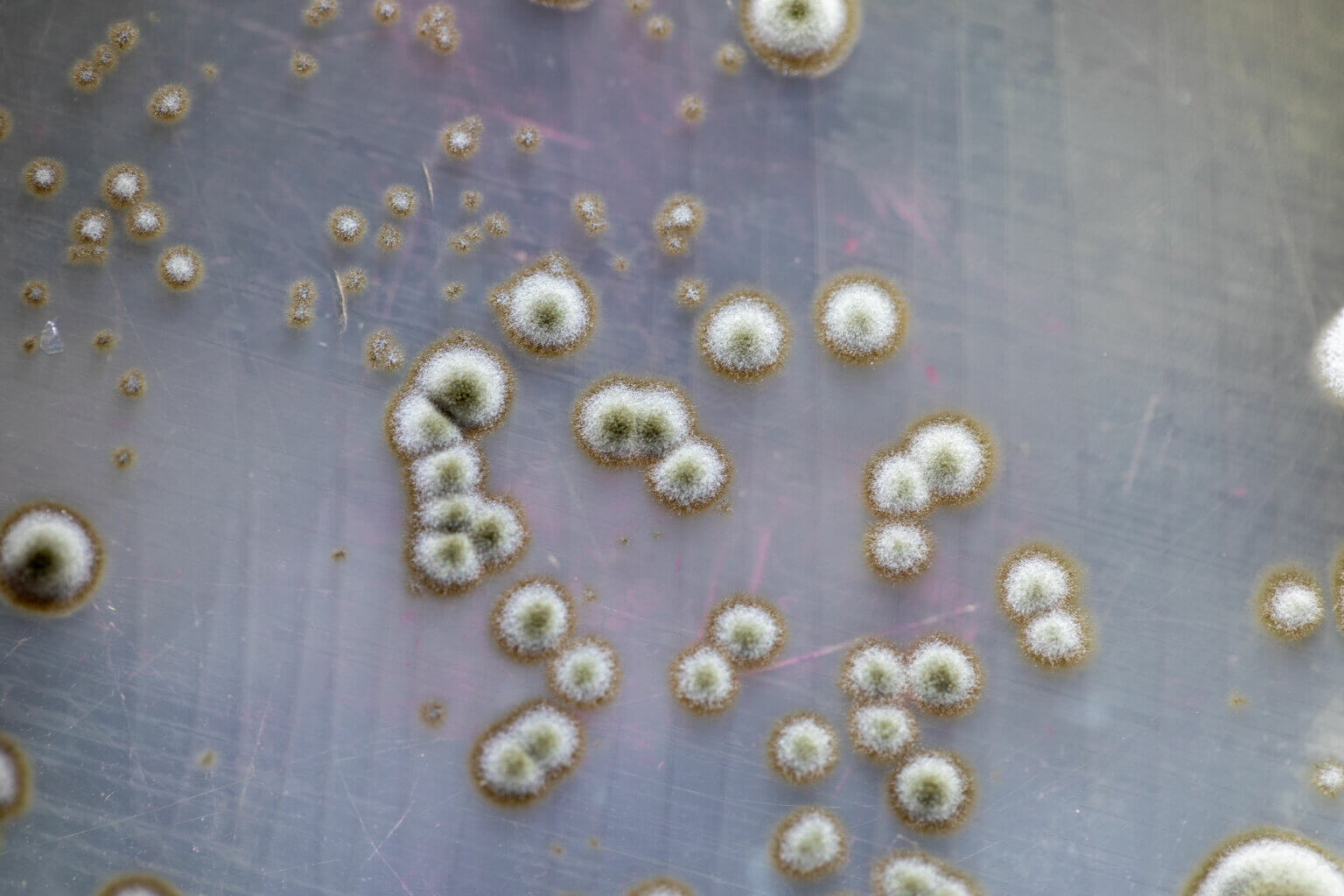 ¿Por qué se produce la caspa y cómo prevenirla? - Muy Salud