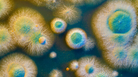 Germs: what are they, characteristics and types