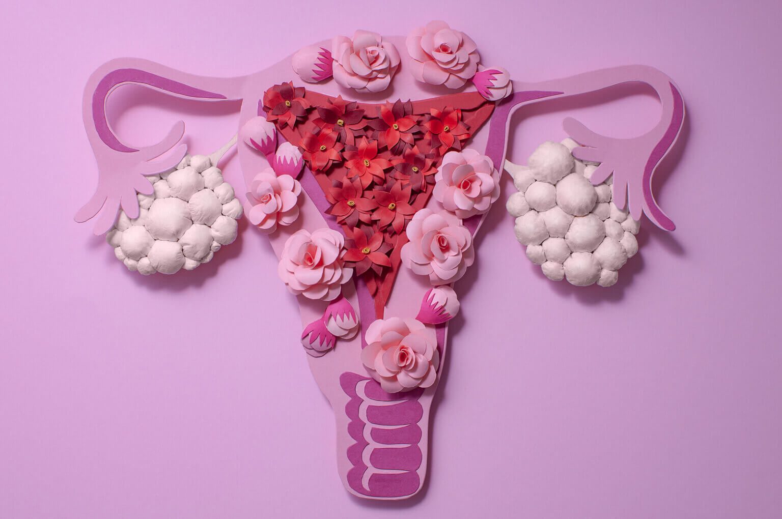 Causas y factores de riesgo de la endometriosis - Muy Salud
