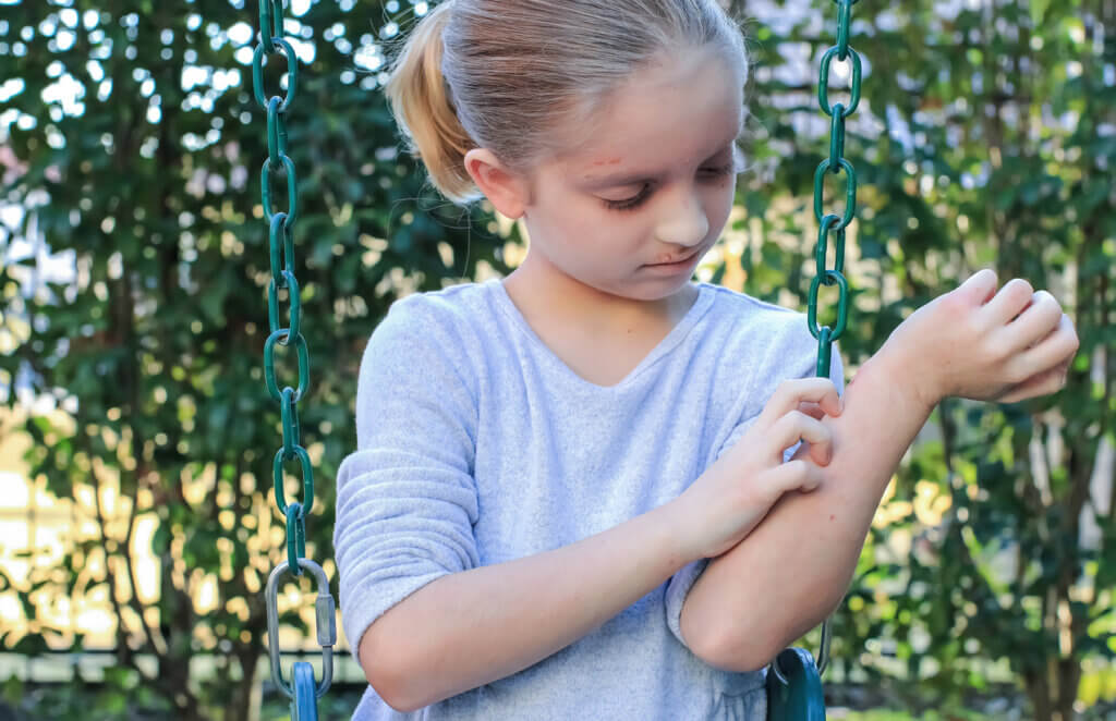 The 13 Most Common Allergies