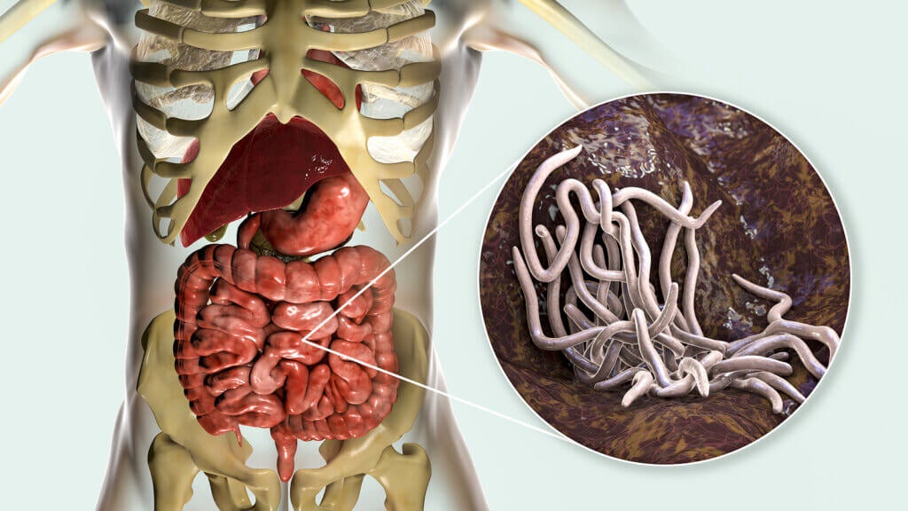 Les 9 types de parasites et leurs caractéristiques