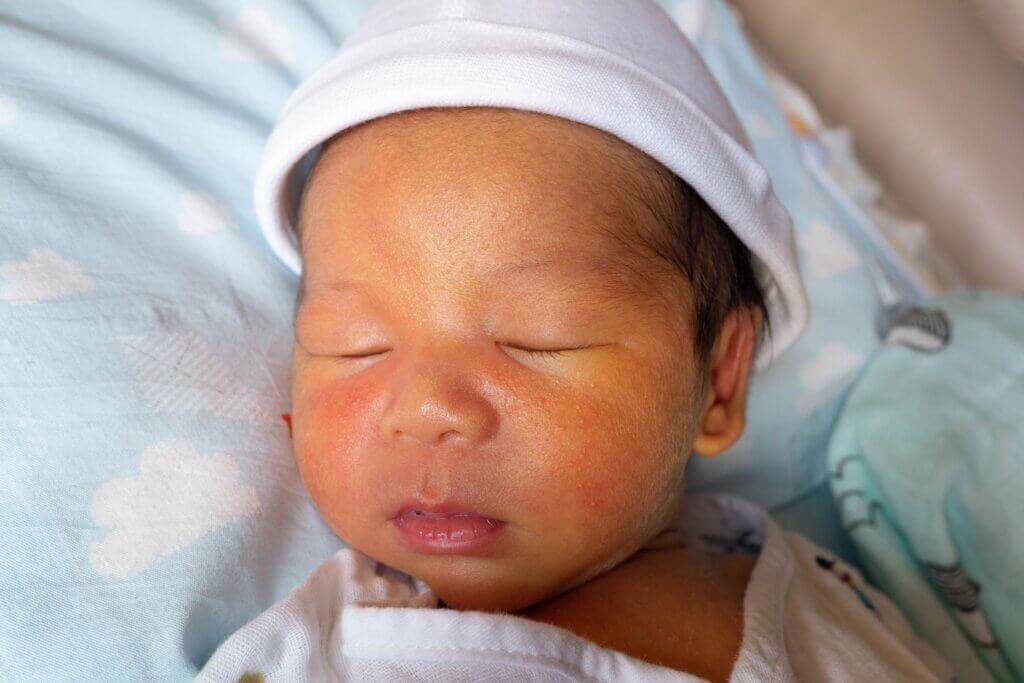 Hepatitis B bij baby's en kinderen