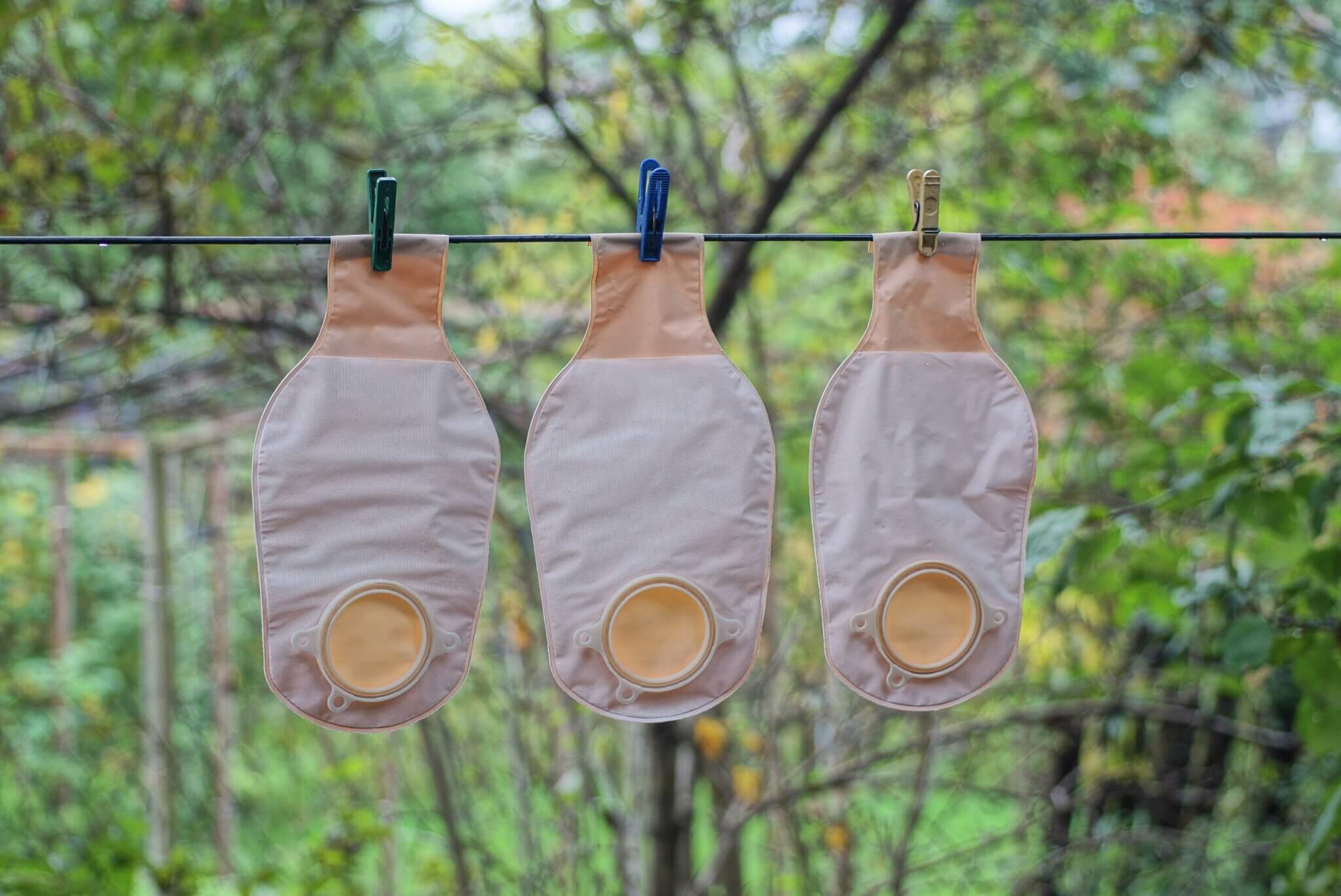 7 consejos para vivir con una ileostomía - Muy Salud