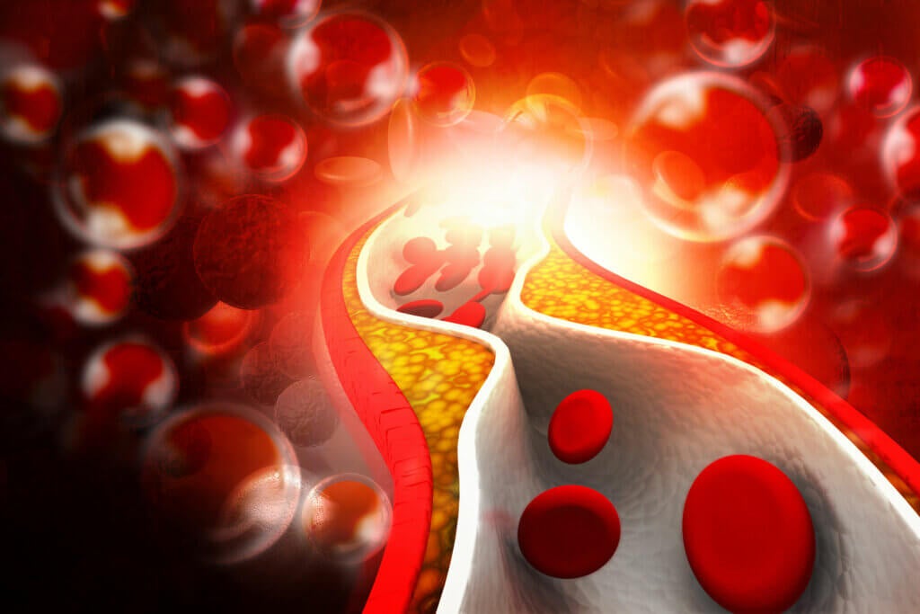 Cholesterolmedicatie: gebruik en bijwerkingen